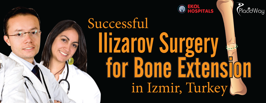 Effective Ilizarov Surgery for Bone Extension in Turkey - PlacidBlog