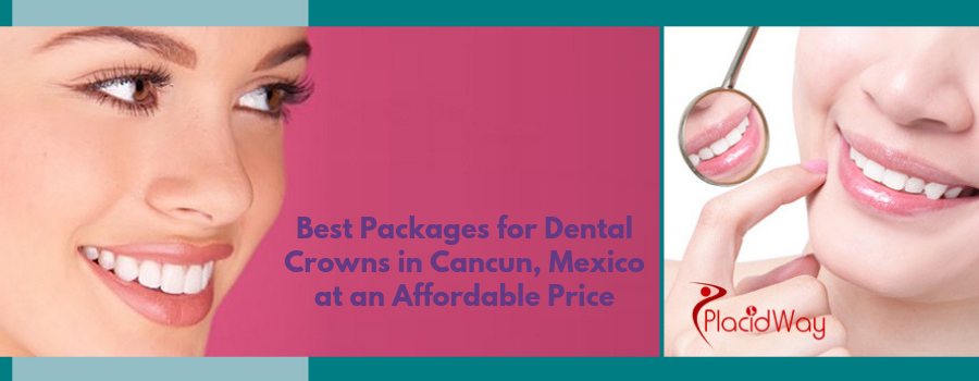 The Most Affordable Dental Crowns Package in Cancun, Mexico - PlacidBlog