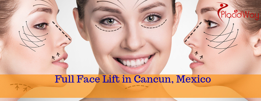 Most Affordable Full Face Lift Package in Cancun, Mexico